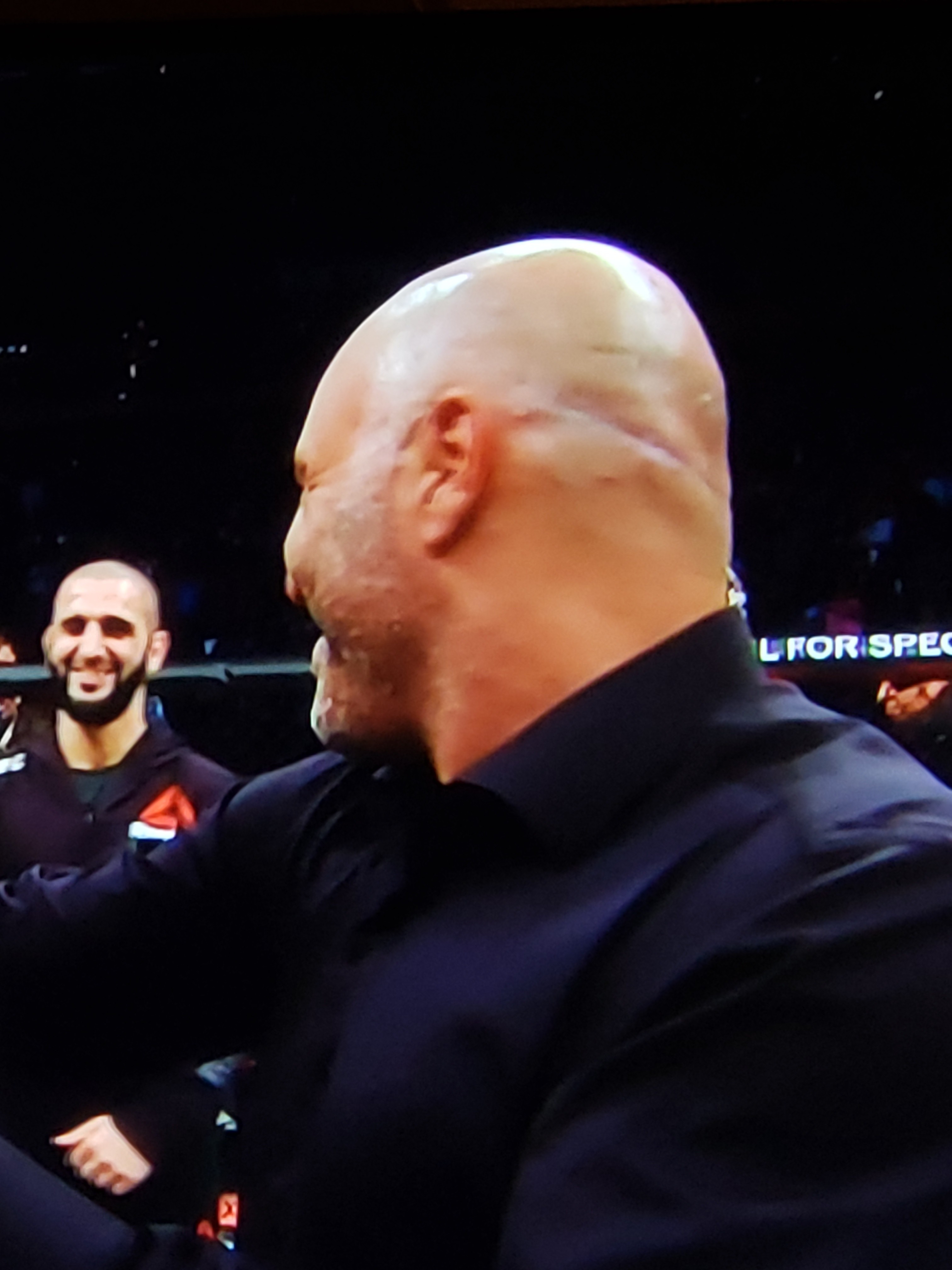 Joe Rogan Hair Transplant Scar